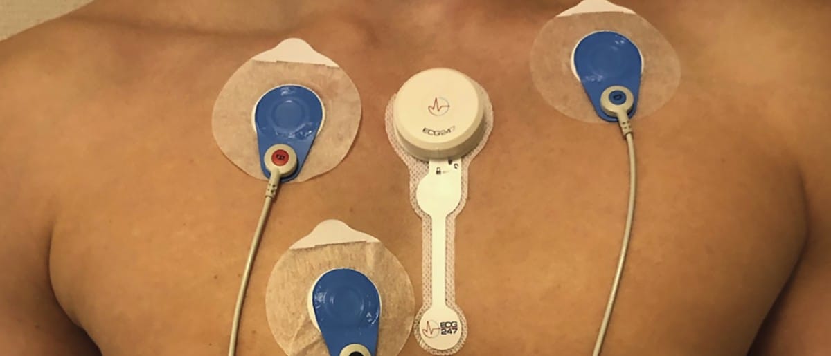ECG247 bedre enn dagens sykehusutstyr - ECG247