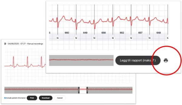 Ny funksjon i ECG247-portalen: Skriv ut eller lagre enkelt EKG-striper ...