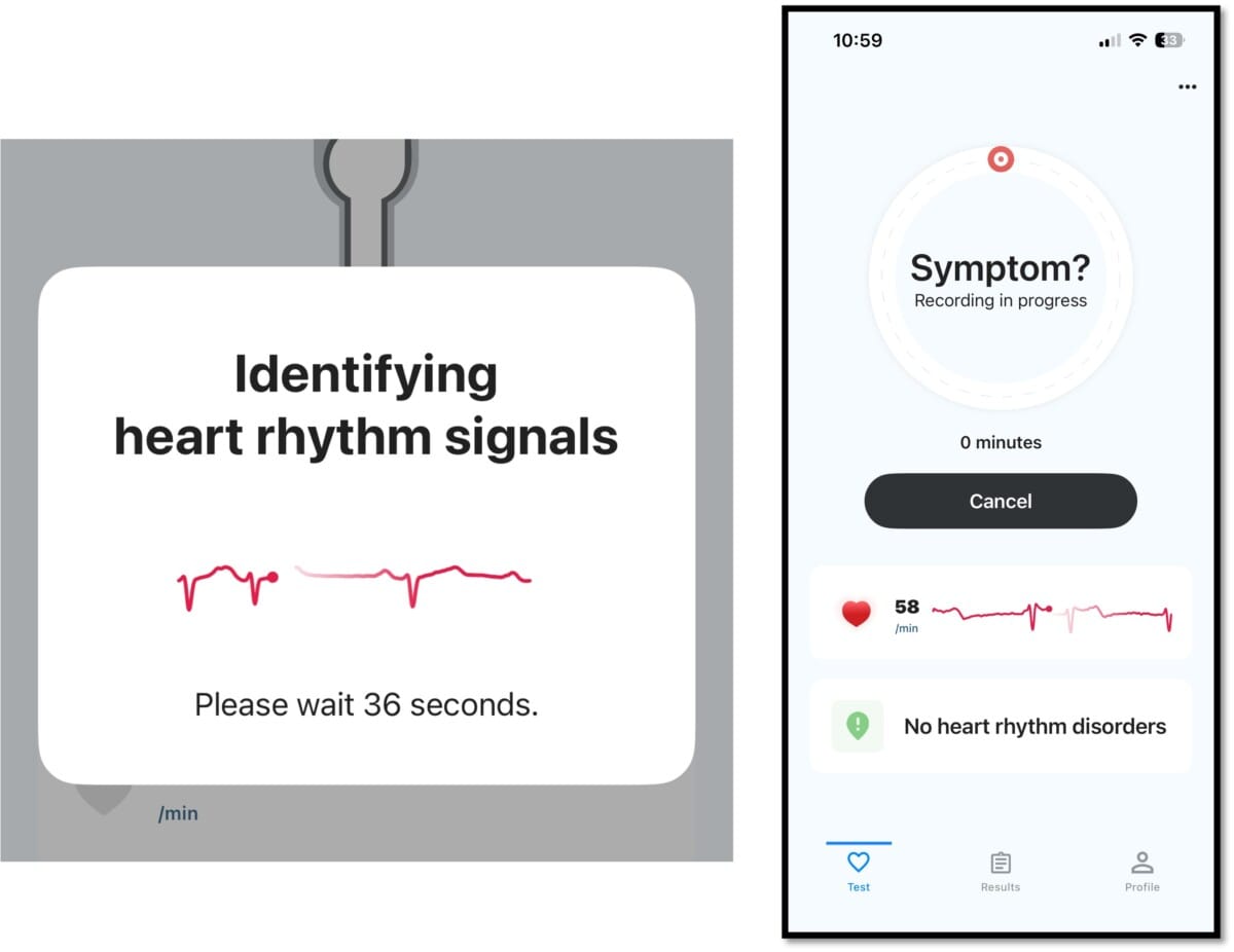 Improved ECG247 app - ECG247
