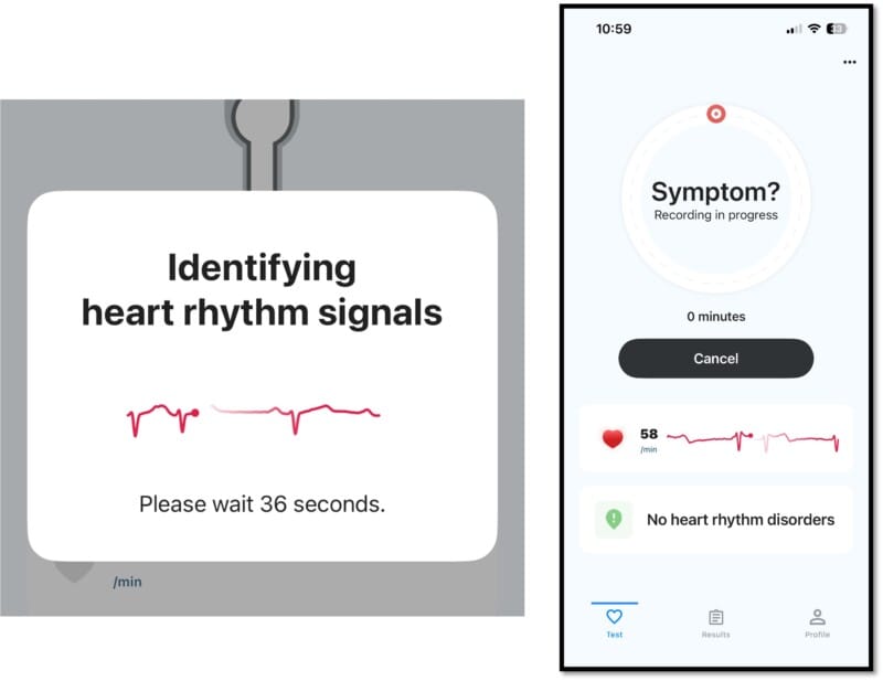 Improved ECG247 app - ECG247